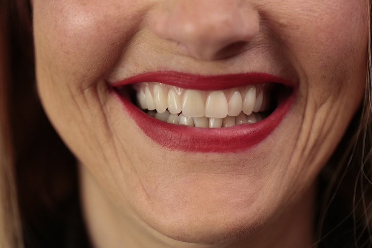 Financement - Ivoire Santé Dentaire